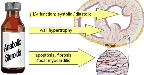 How Anabolic Steroids Affect the Heart